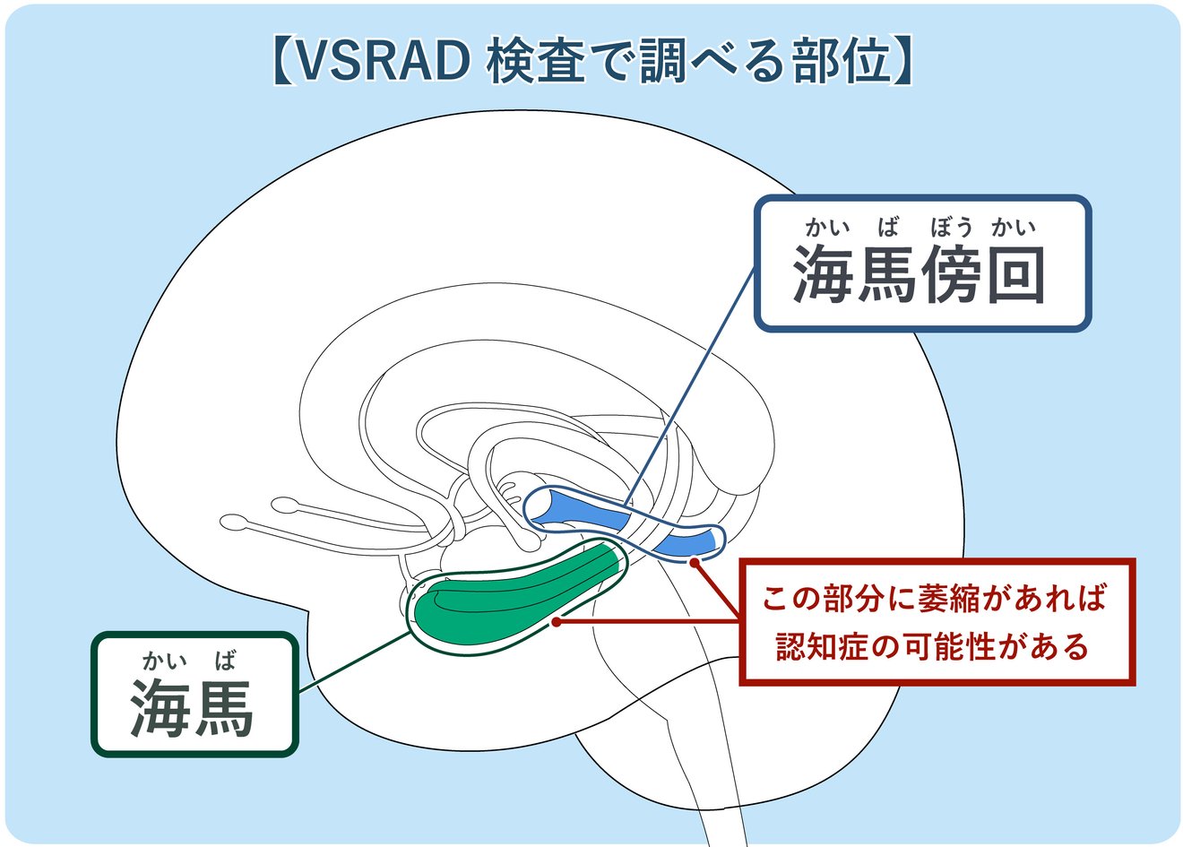 【認知症検査】VSRAD (ブイエスラド)とは？ - LIFULL 介護(ライフル介護)